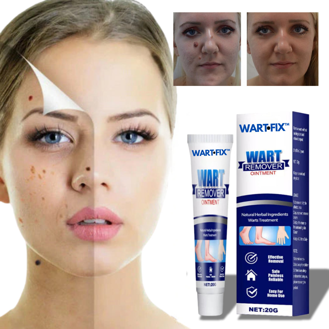 WartFix™ | Vårtkräm | Tar bort vårtor och fläckar snabbt och smärtfrit ...